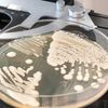 Hefepilz Candida auris – Die Symptome